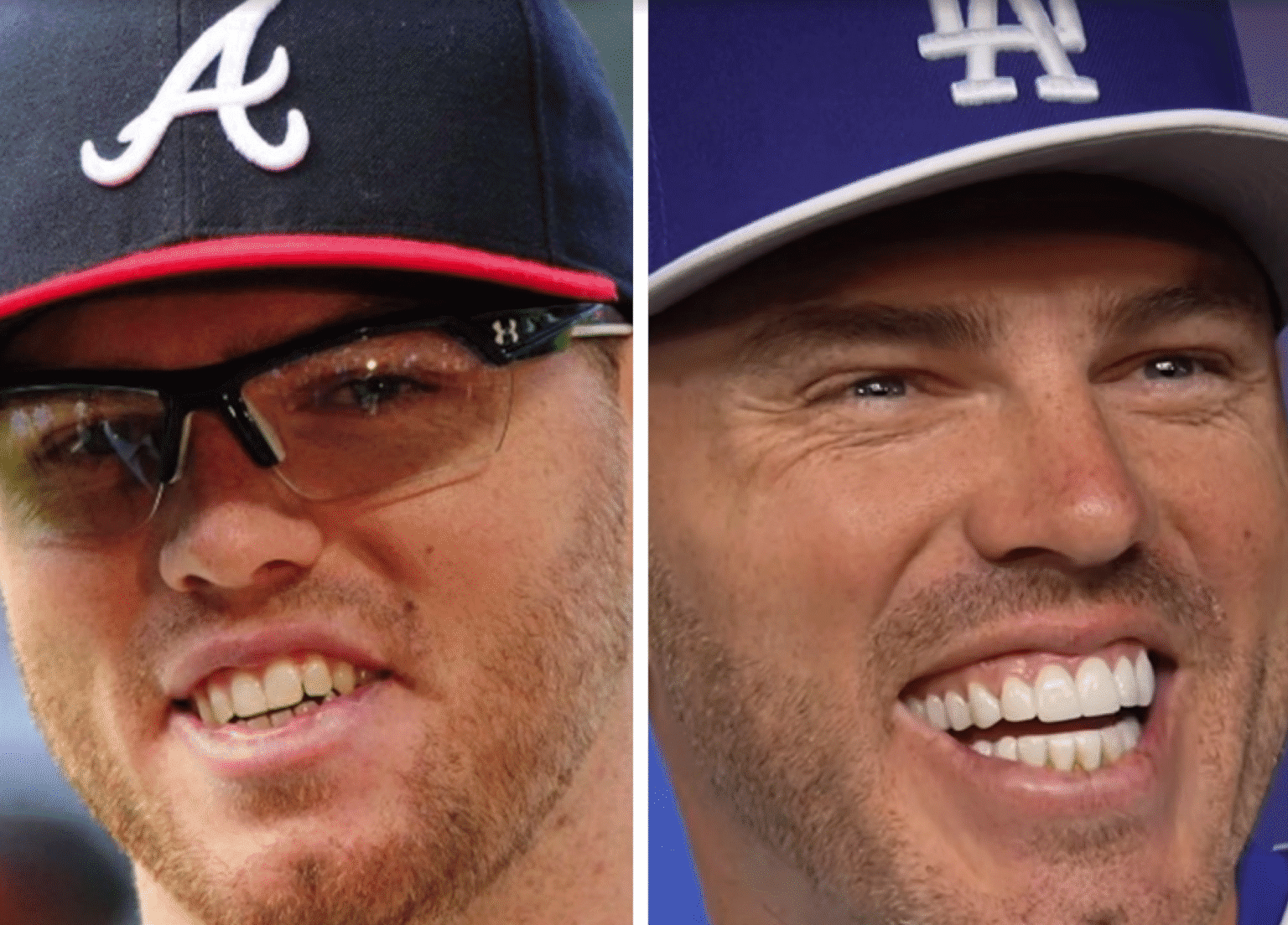 Freddie Freeman Veneers Before and After: Did Cosmetic Dentistry Go Too ...